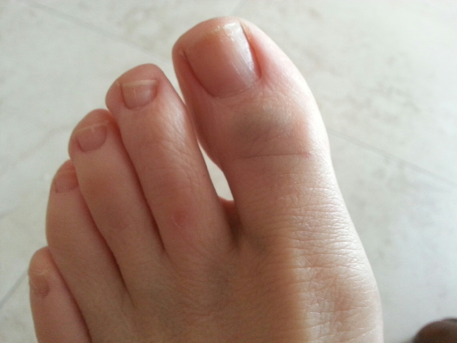Big toeing the line… or not – All Things Work Together